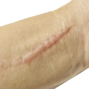 Pain Relief and Healing: Ace Pain Clinic - Pain Treatment